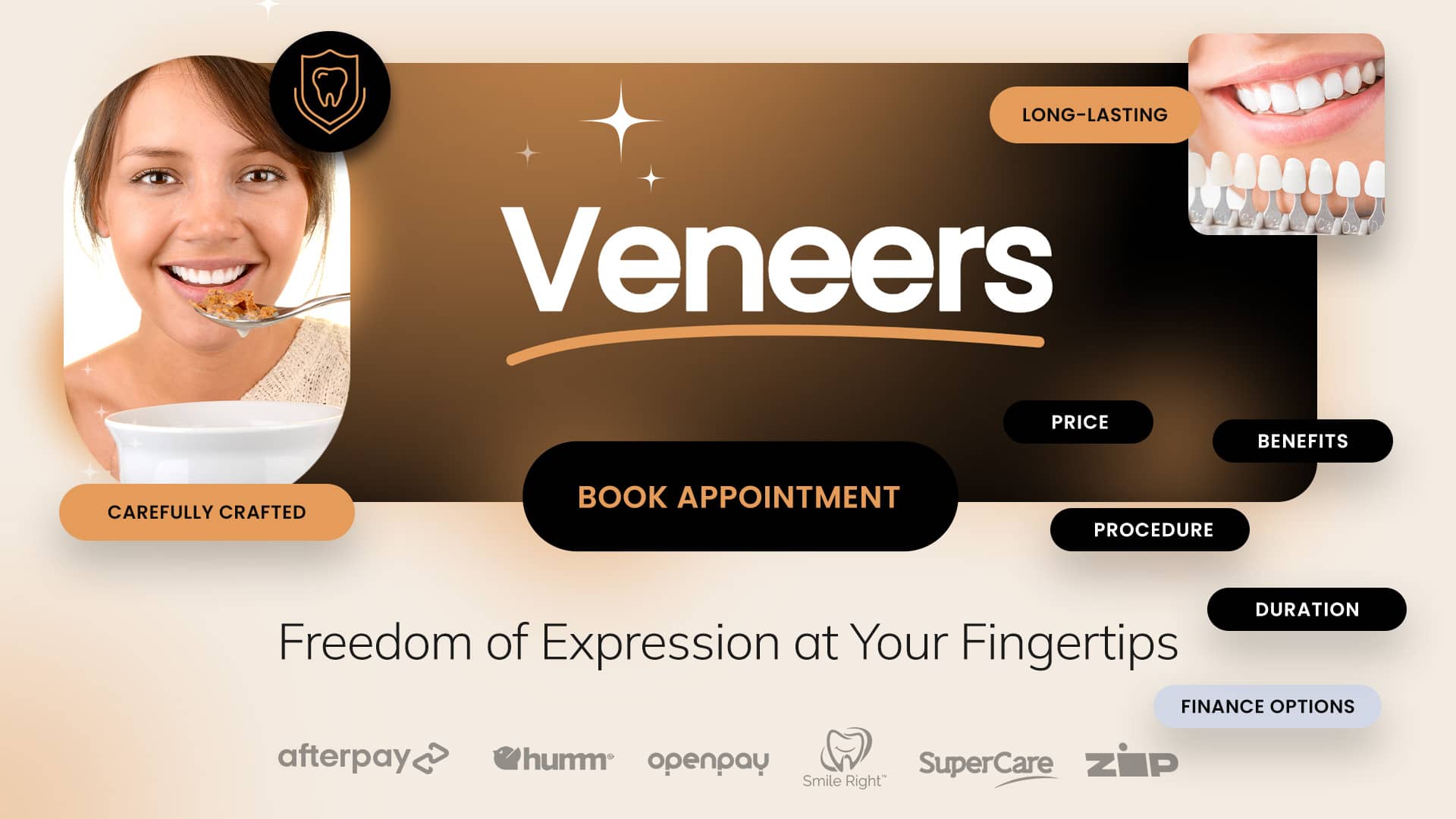 Veneers - Benefits, Procedure, Treatment Duration, Prices